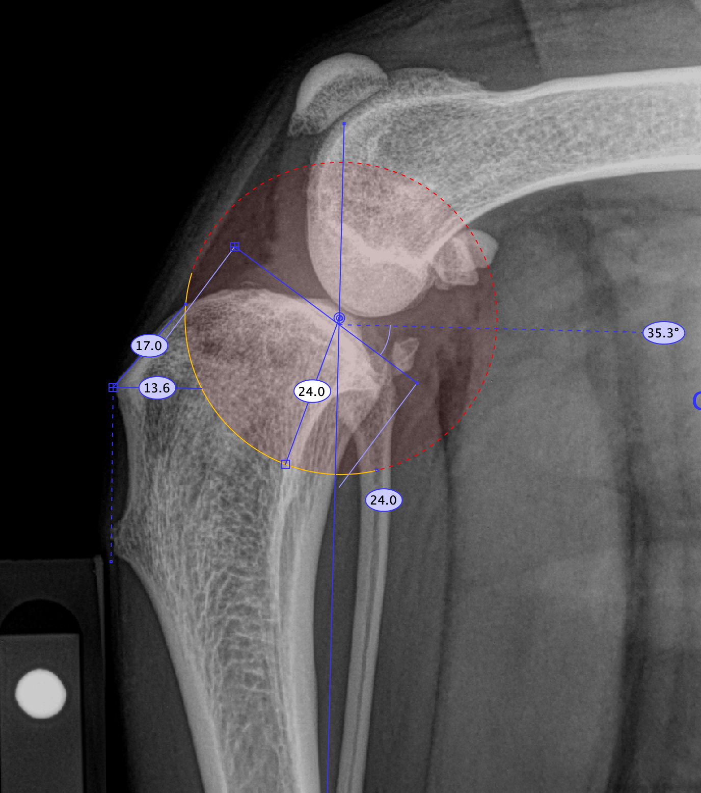 Benefits of Pre-Operative Planning for TPLO - Arizona Canine ...